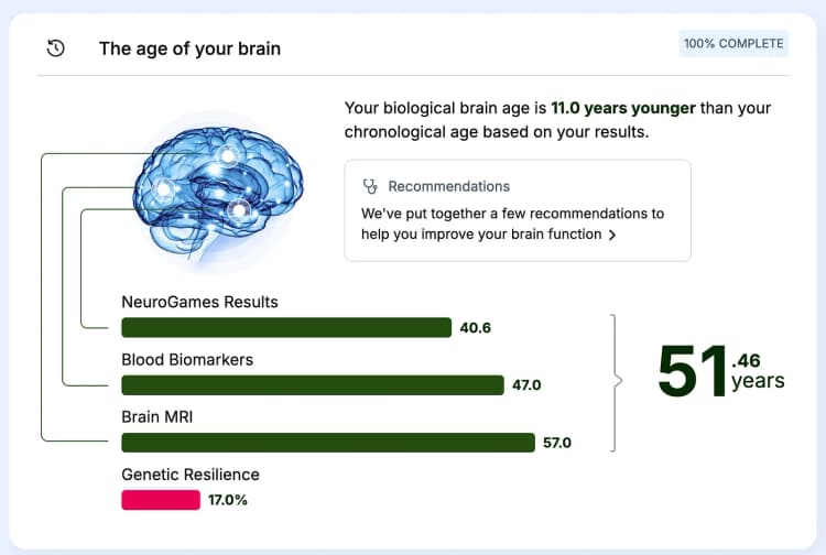 Thinking about Alzheimer’s